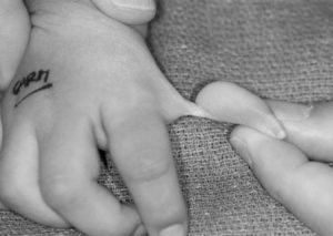 Clinical Care of Hand and Arm Abnormalities in Fanconi Anemia - Fanconi ...